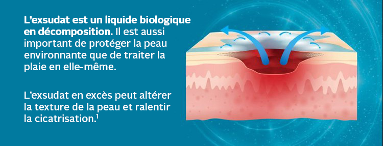 Superabsorbant ConvaMax™ | Gestion optimale de l'exsudat